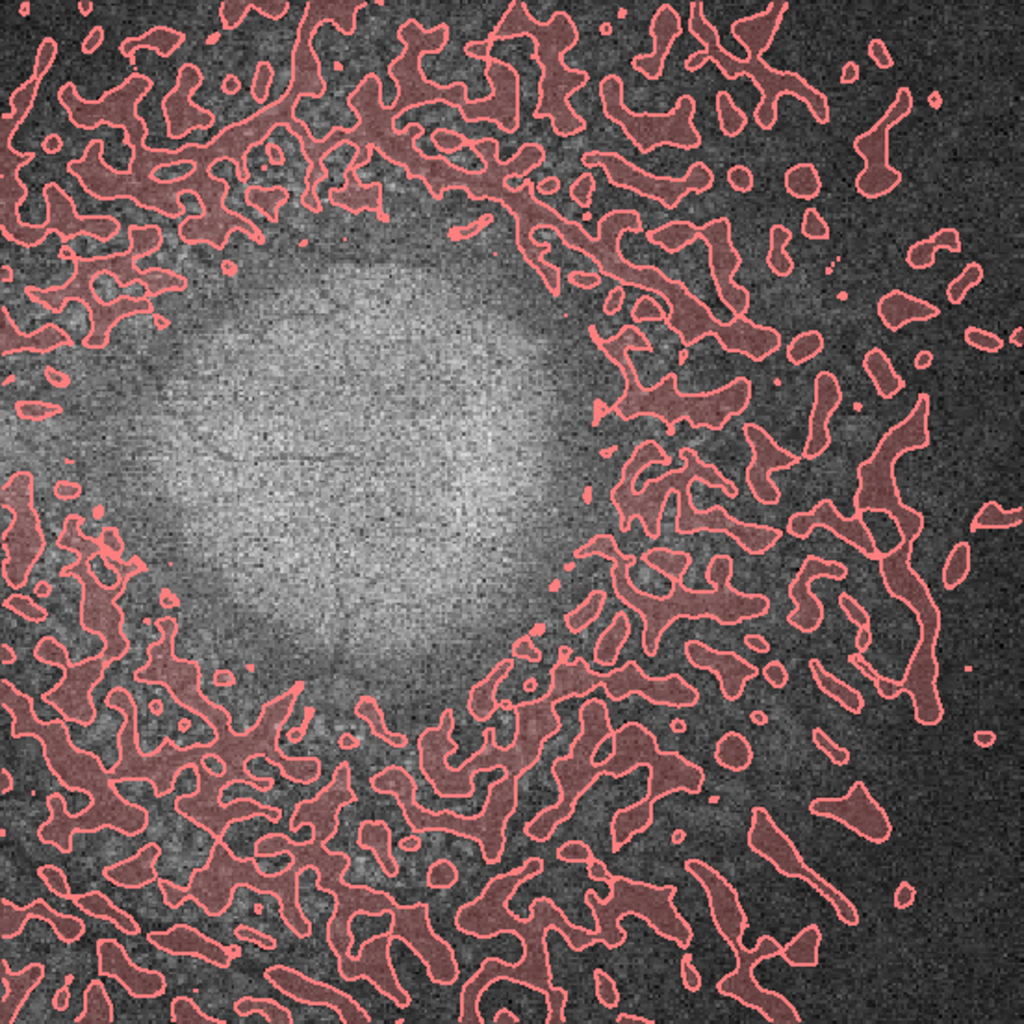Ophthalmic Image Analysis | Iowa Institute for Biomedical Imaging - The ...