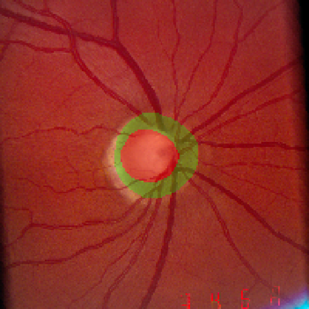 Ophthalmic Image Analysis | Iowa Institute for Biomedical Imaging - The ...