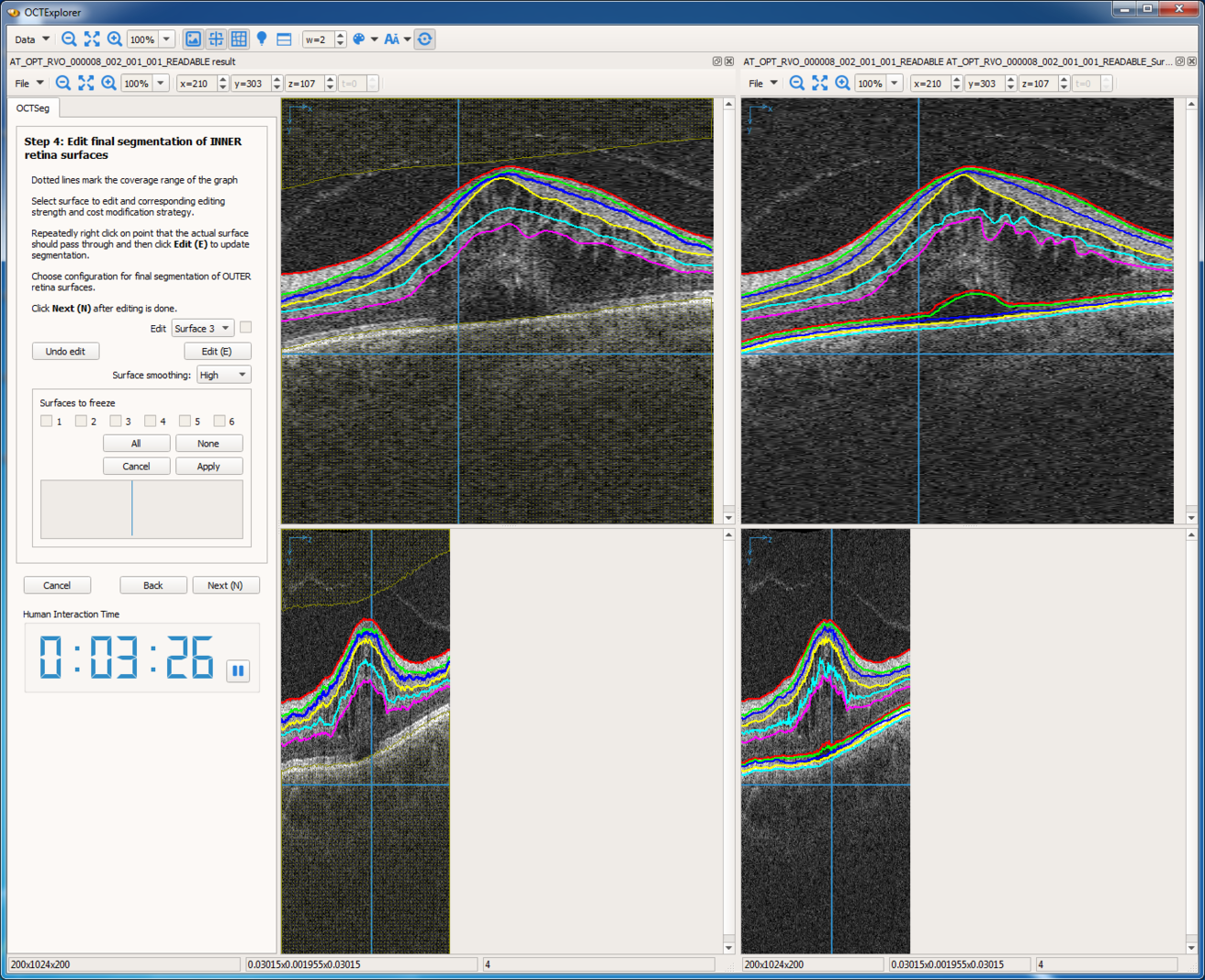 Ophthalmic Image Analysis | Iowa Institute for Biomedical Imaging - The ...