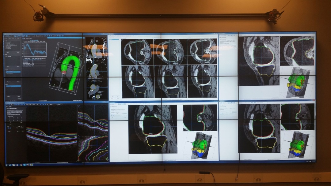 IIBI Visualization Lab | Iowa Institute for Biomedical Imaging - Carver ...