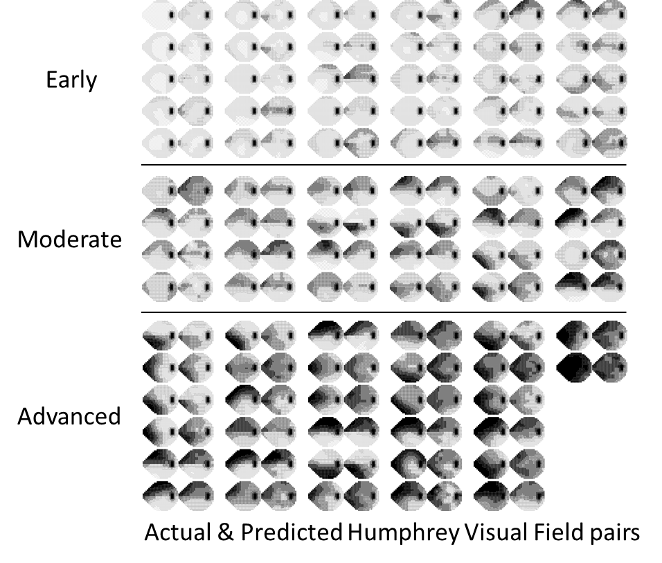 Ophthalmic Image Analysis | Iowa Institute for Biomedical Imaging - The ...