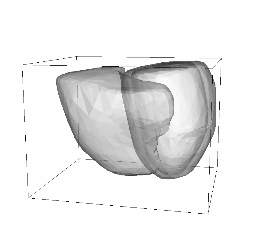 Cardiovascular Image Analysis | Iowa Institute for Biomedical Imaging - Carver College of ...