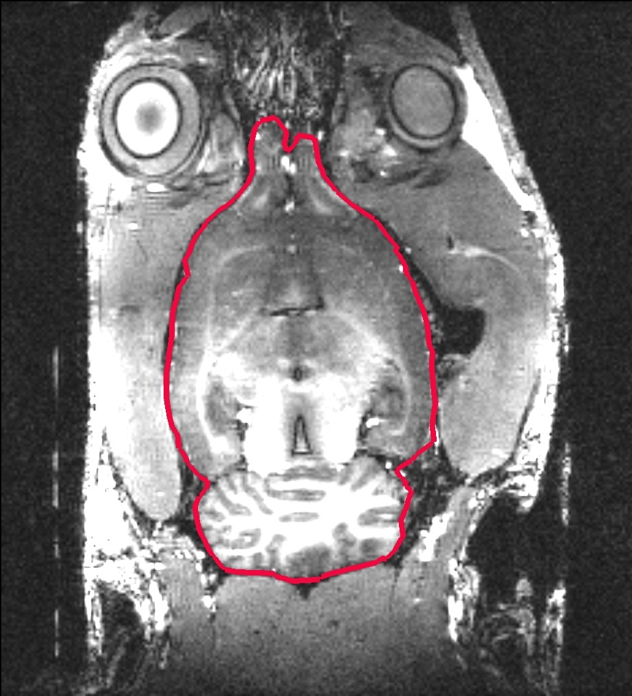 Downloads | Iowa Institute for Biomedical Imaging - Carver College of ...