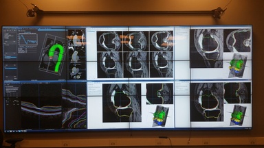 IIBI Visualization Lab | Iowa Institute for Biomedical Imaging - Carver ...