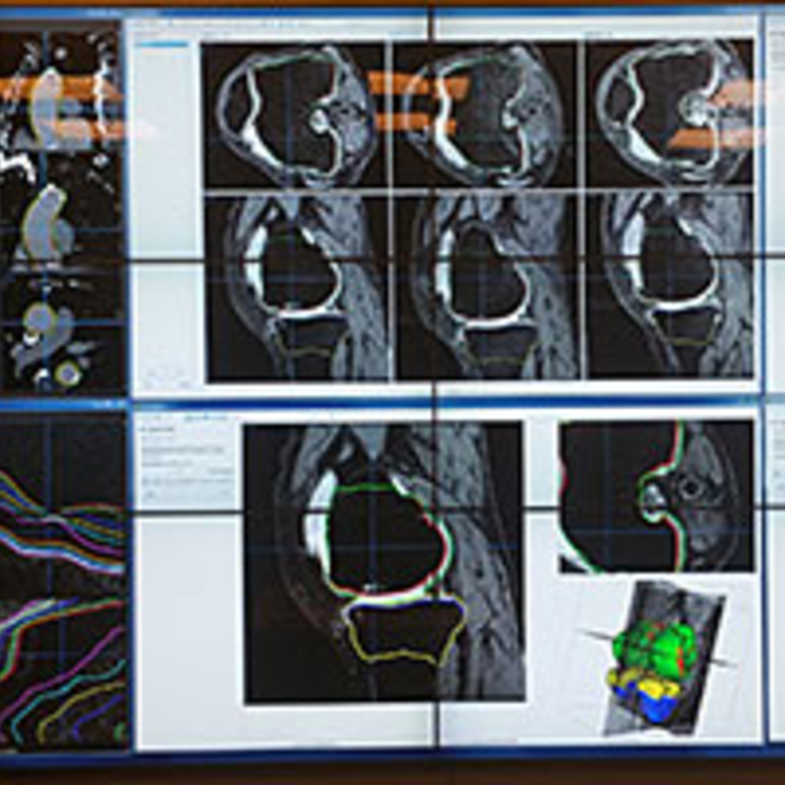 Iowa Institute for Biomedical Imaging | The University of Iowa