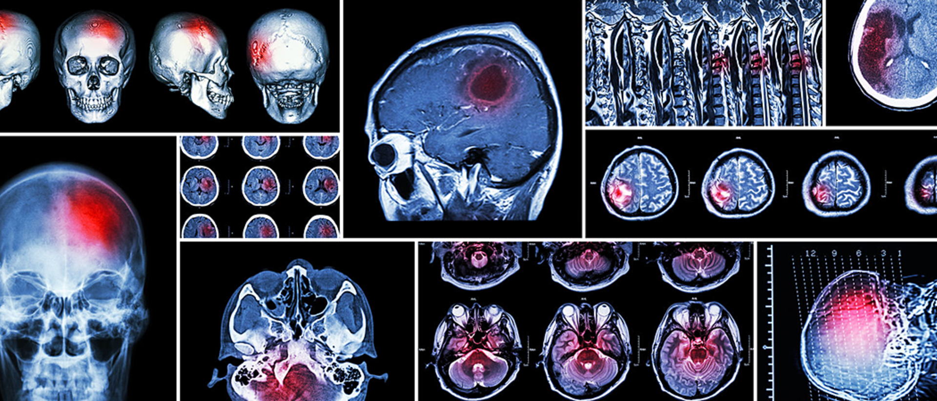 Iowa Institute for Biomedical Imaging | Carver College of Medicine ...